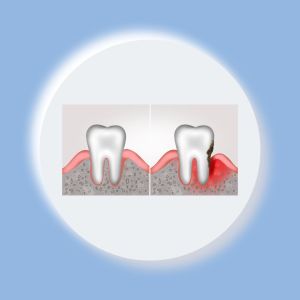 Çene kemiğinde erime olur mu? - Uzm. Dr. Şehrazat Ziya